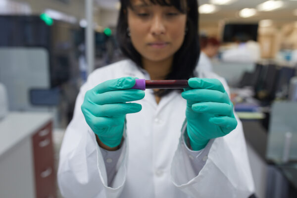 Why Iron Matters for Blood Donors: Protecting Your Health